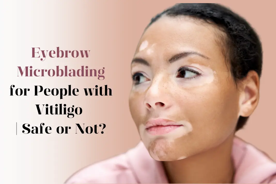 Eyebrow Microblading for People with Vitiligo: Safe or Not?